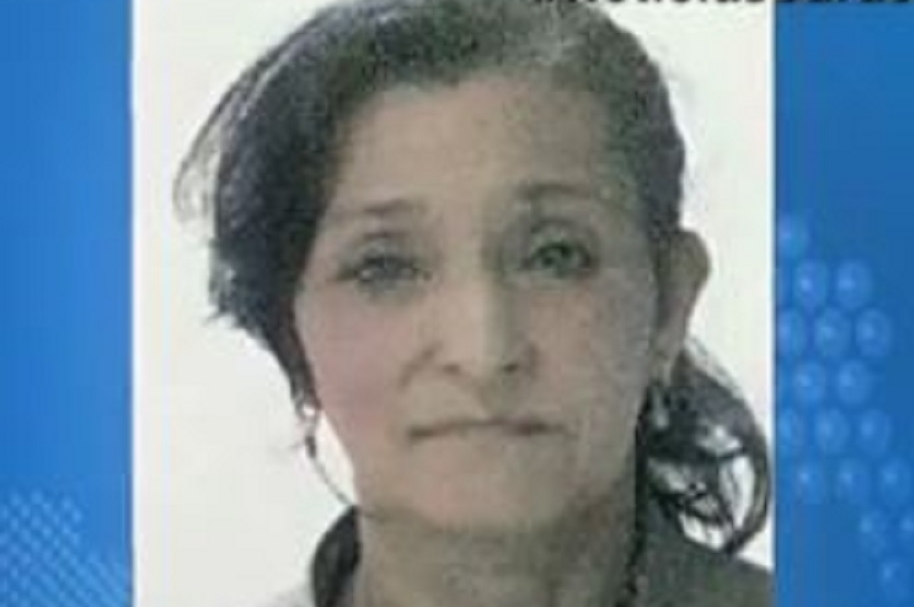Mujer atacada con ácido por celos Mujer atacada con ácido por celos
